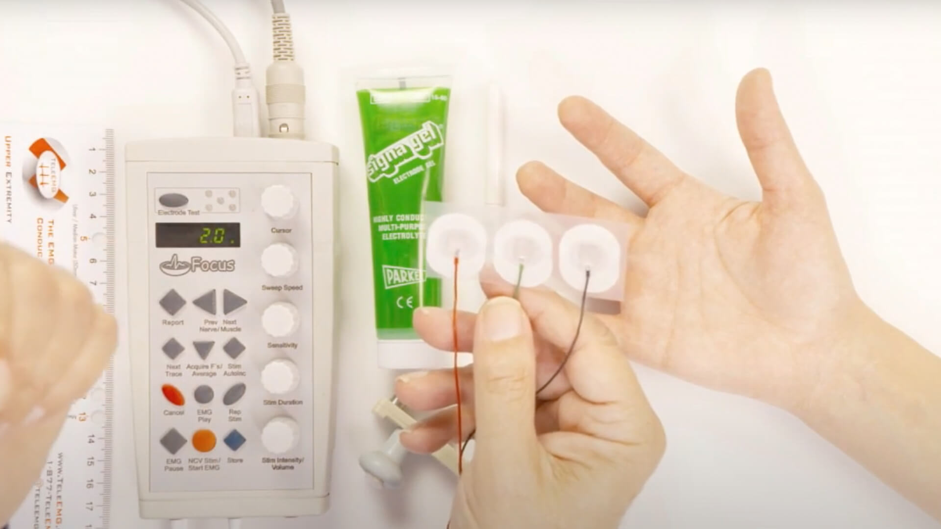 NCV Exam - Ulnar Motor - CloudEMG Videos - CloudNeuro