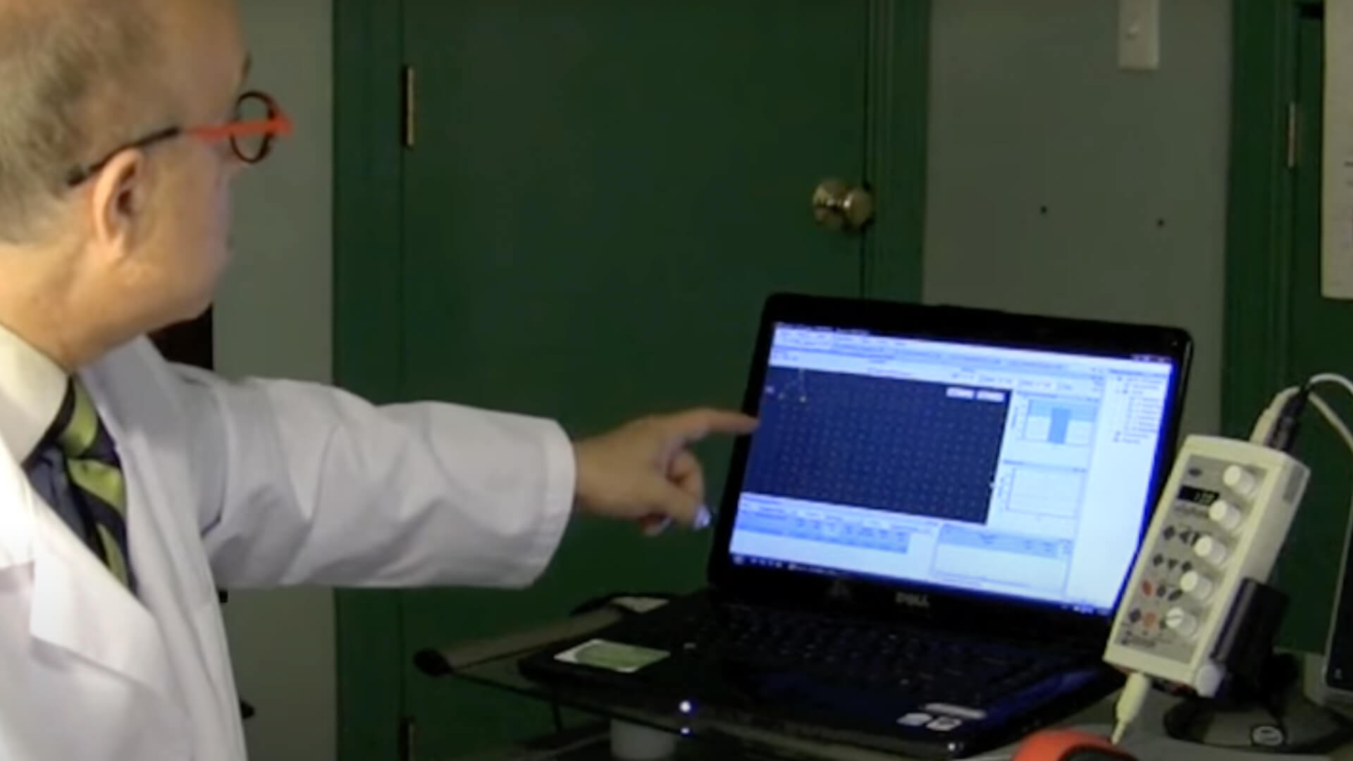 NCV Exam - Median Sensory - CloudEMG Videos - CloudNeuro